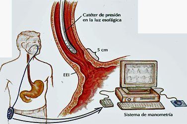 GASTROMEDCAL